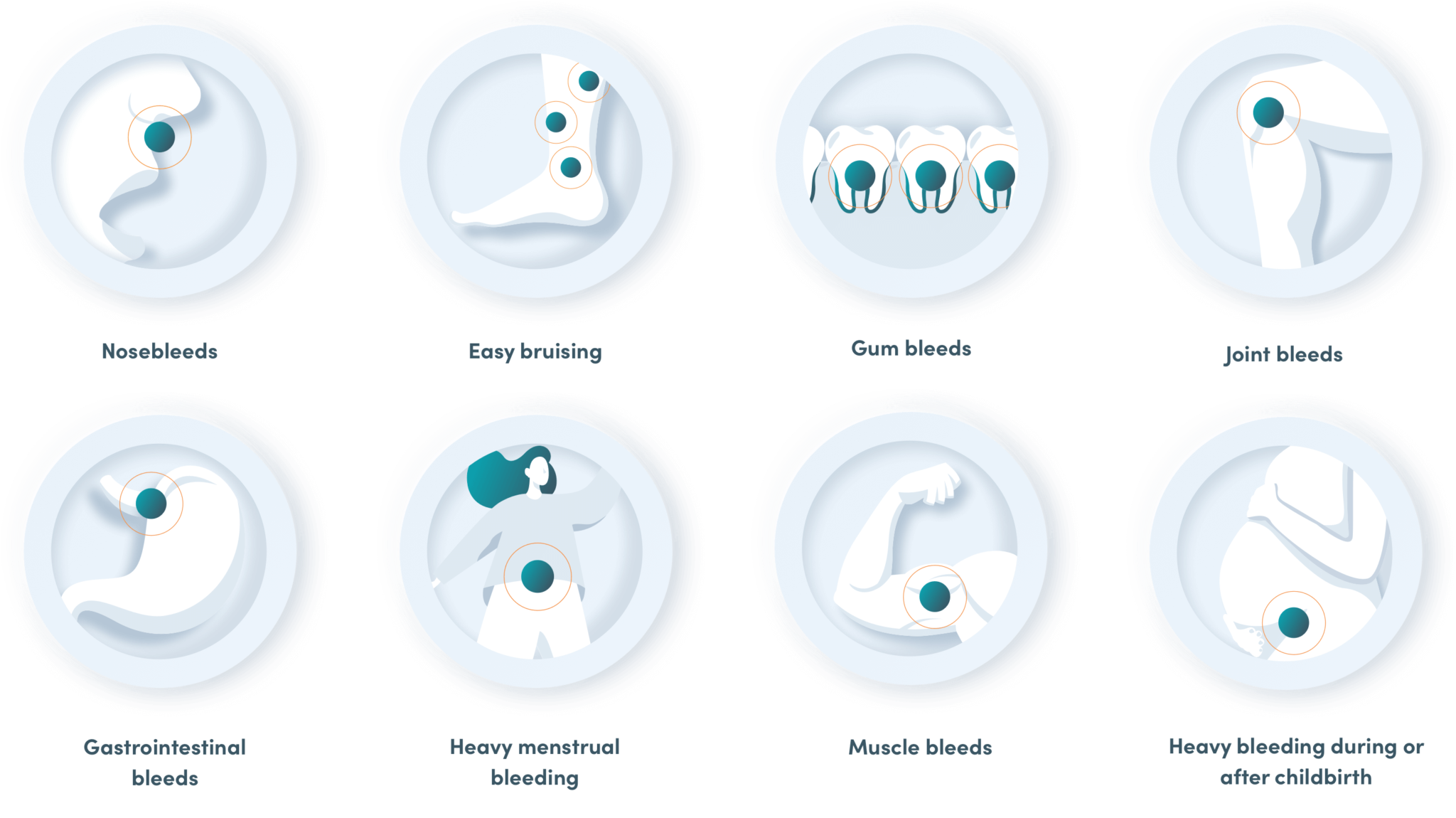 On demand treatment of von willebrand disease